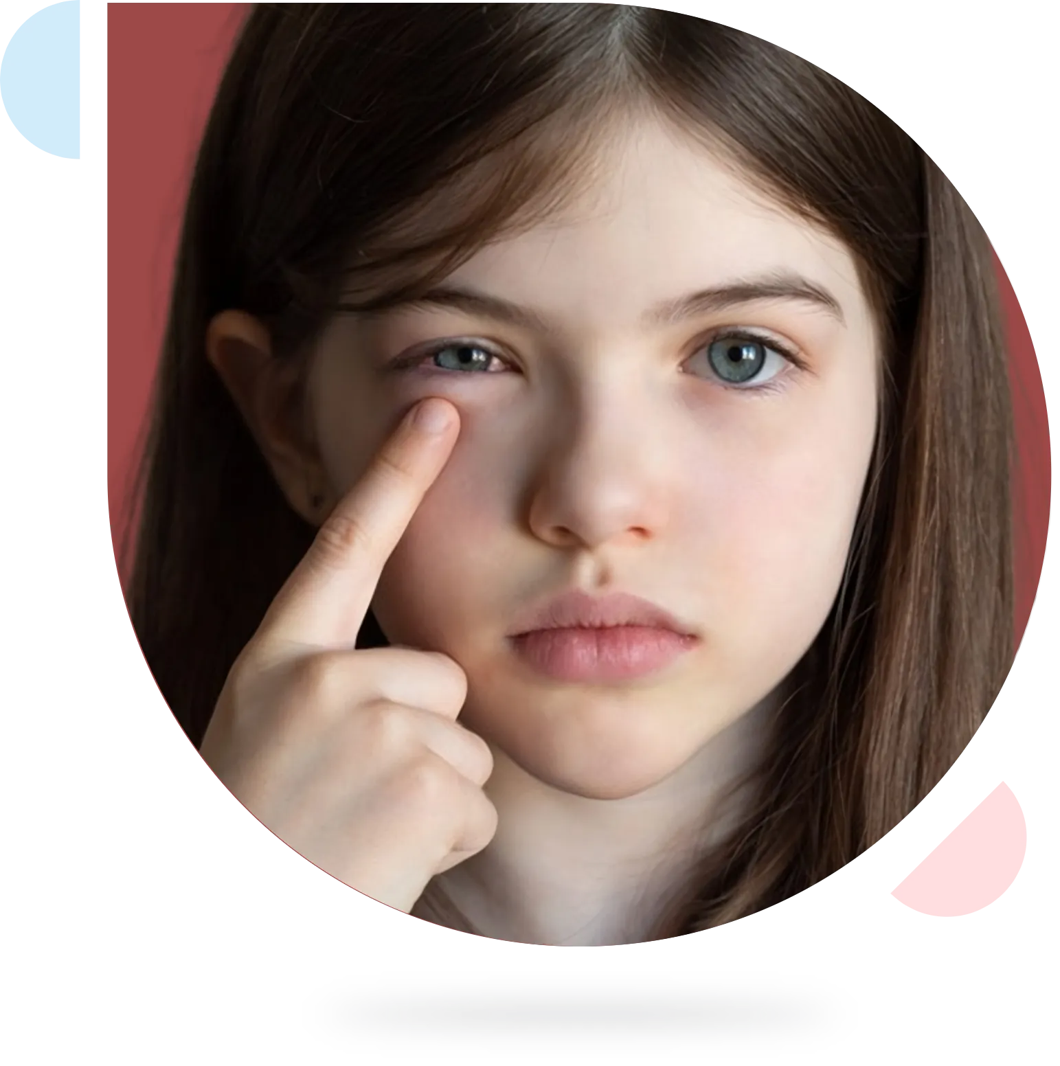 Pink Eye Treatment Online | The CareMD